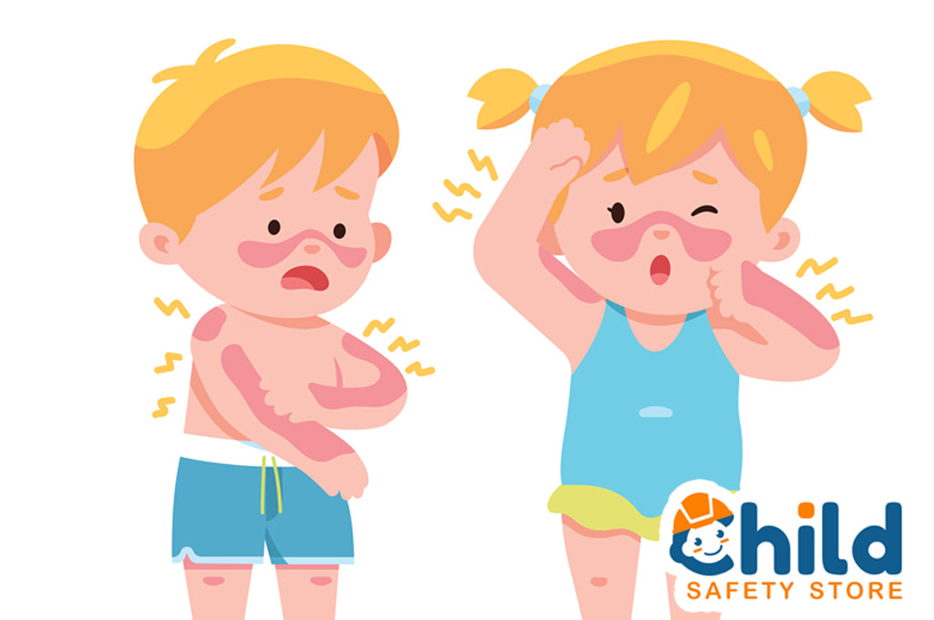National Healthy Skin Month: Caring for Your Baby’s Skin — Child Safety ...