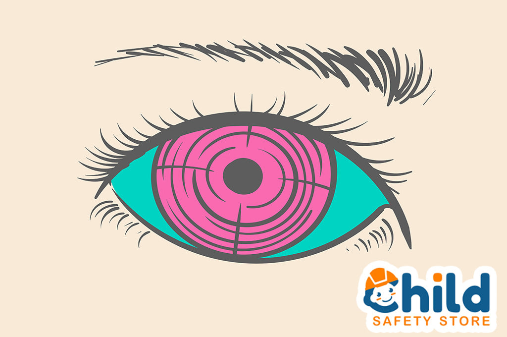 Red Eye Photos Could Be an Early Warning Sign of Childhood Cancer ...